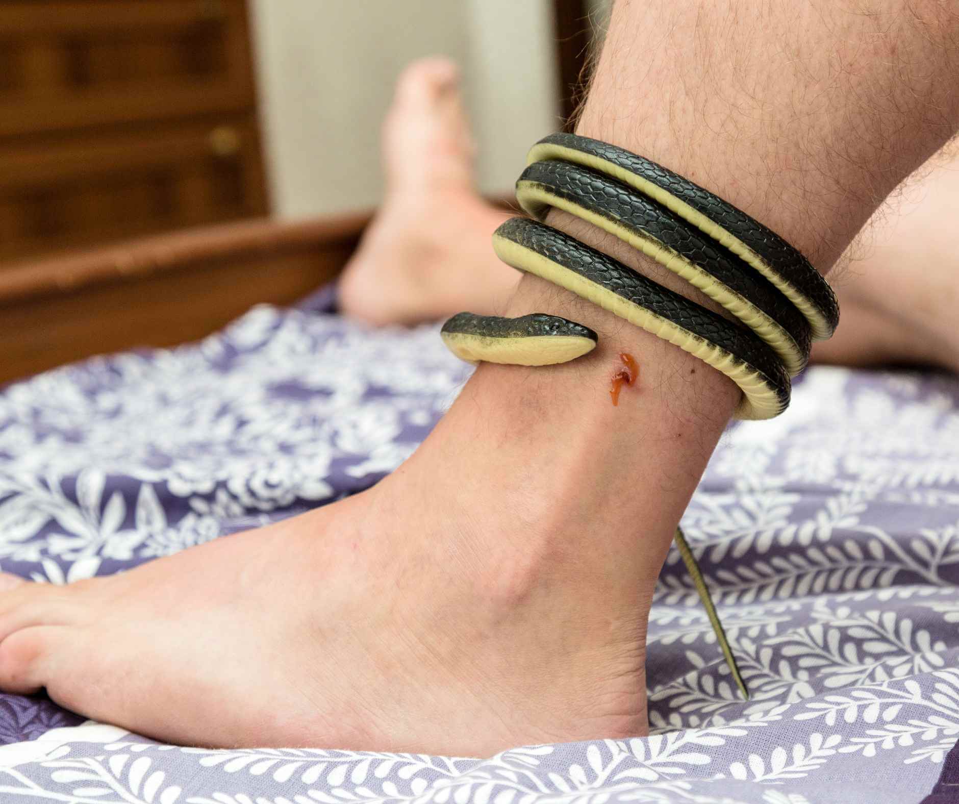 First Aid For Snake Bites In A Child | The First Aid Nest