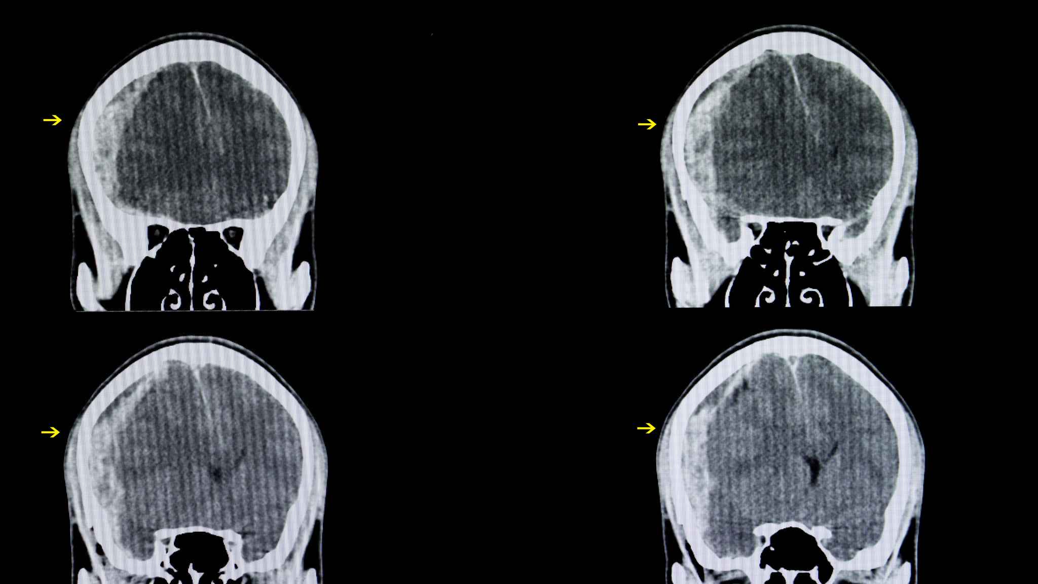 First Aid For Head Injury | The First Aid Nest