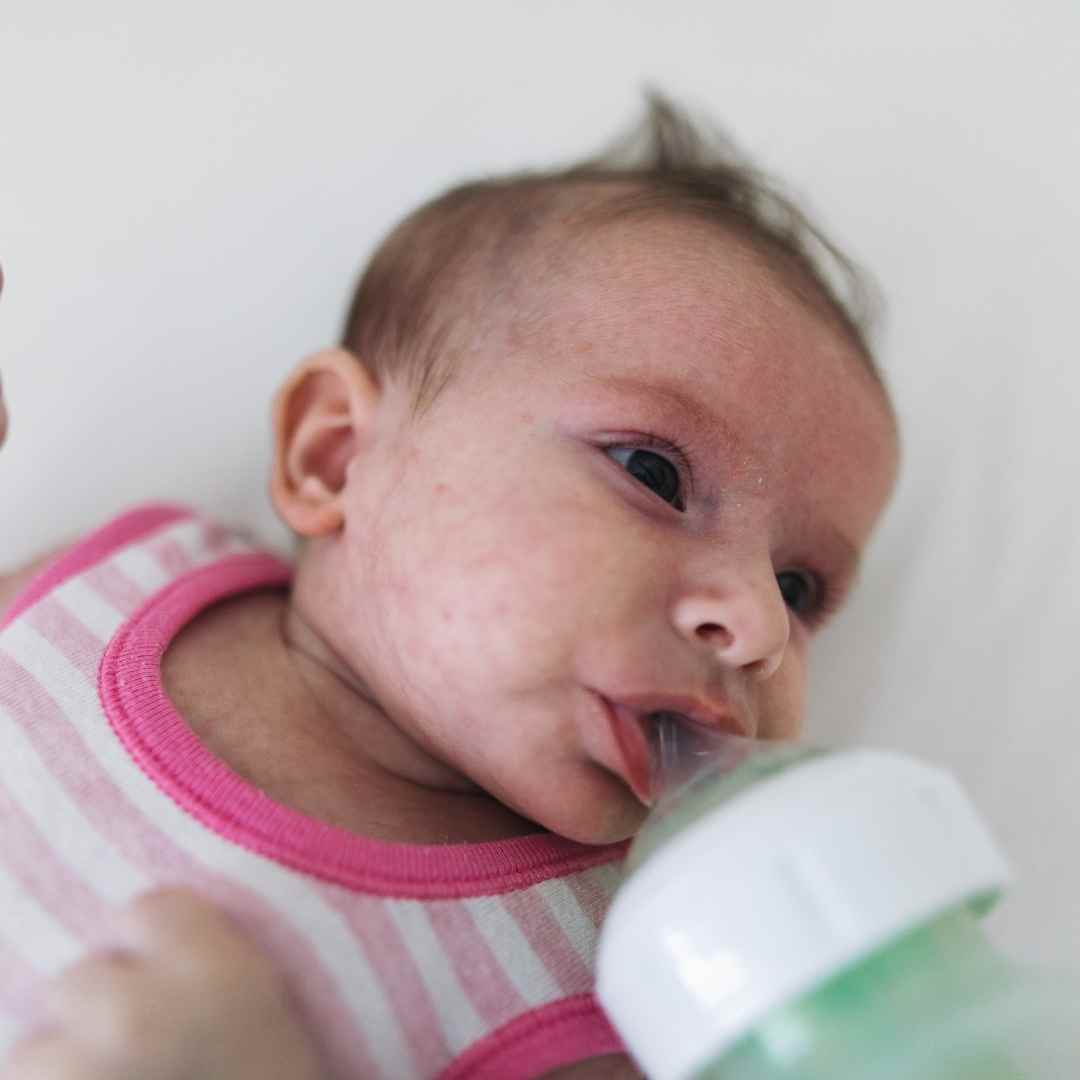 Signs of Dehydration in Babies and Children | The First Aid Nest