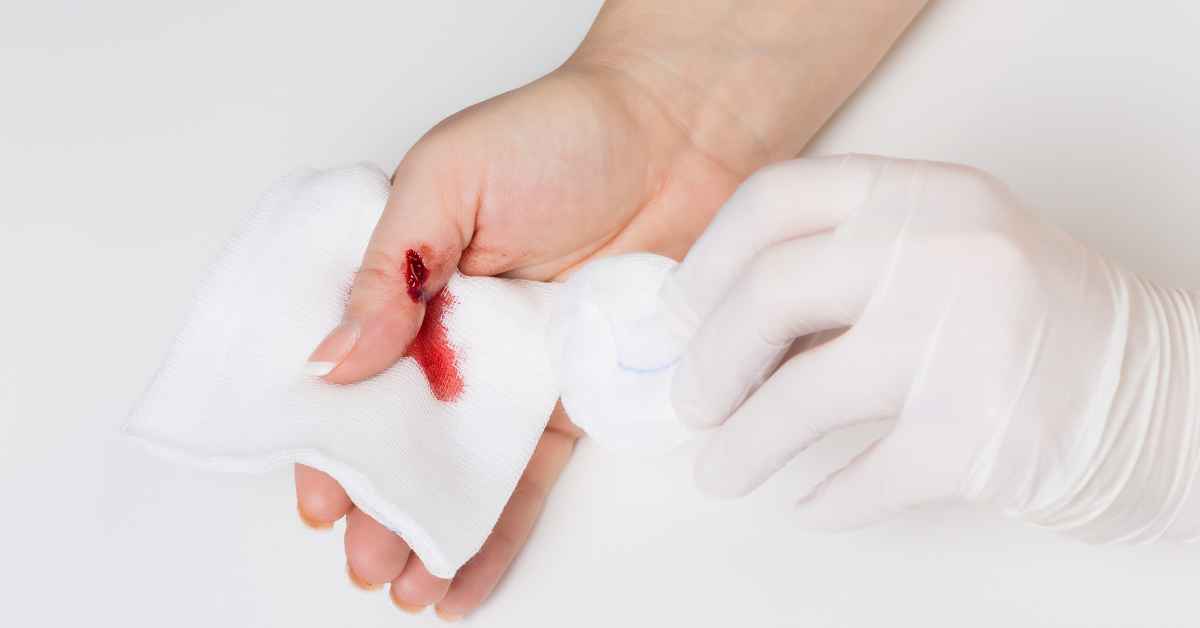 Under Pressure: The Art of Mastering Bleeding Control in First Aid ...